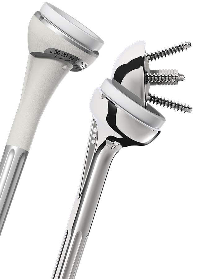 Understanding Reverse Total Shoulder Replacement Surgery