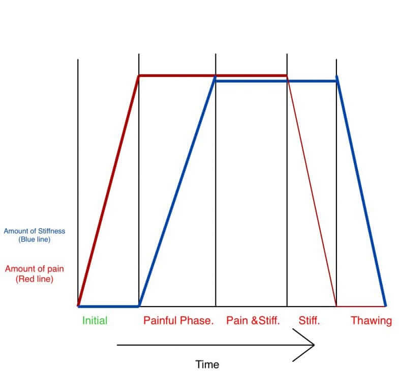 Frozen Shoulder Pain: What You Can Do About It - Orthopaedic Surgeon ...