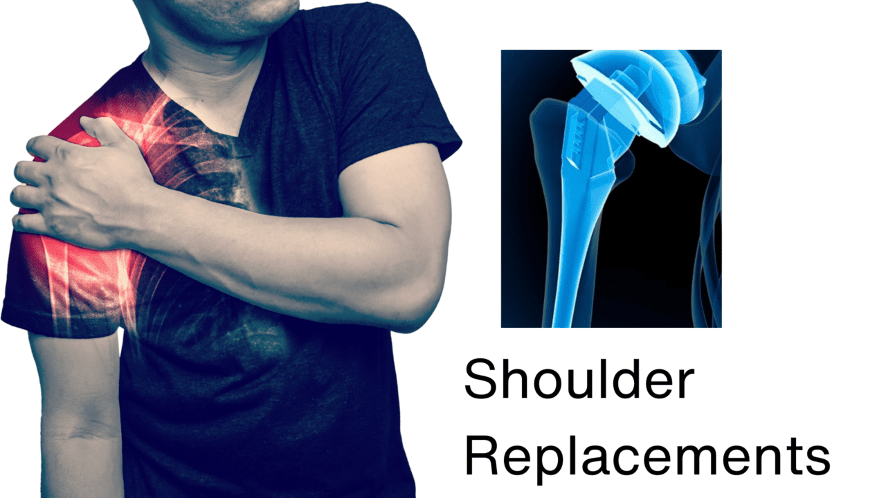 Shoulder Replacement - Orthopaedic Surgeon Adelaide Providing Quality ...